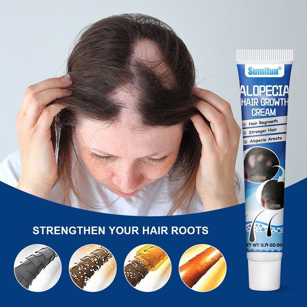 Jual Sumifun Obat Alopecia Areata, Rambut Pitak, Penumbuh Rambut Pitak ...