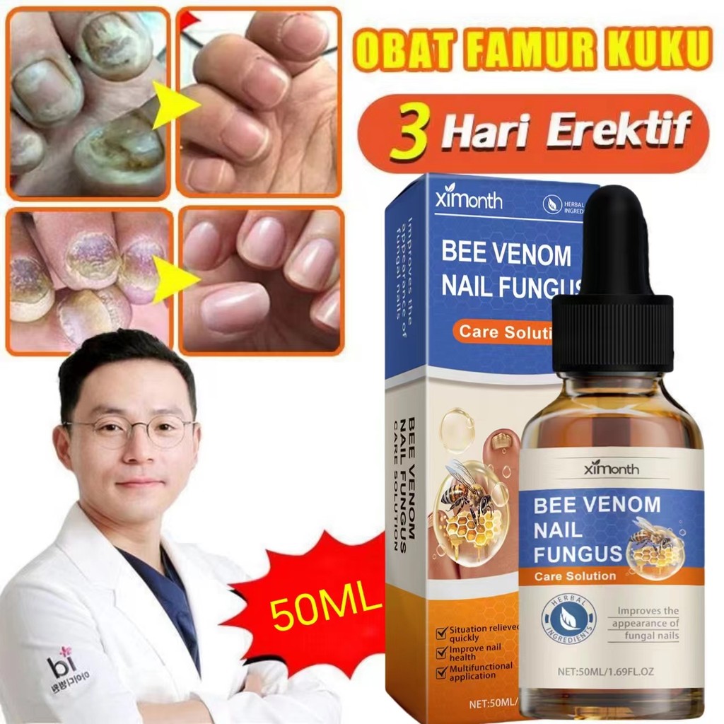 Jual Nail Treatment Feet Care Essence Nail Foot Whitening Toe Nail ...