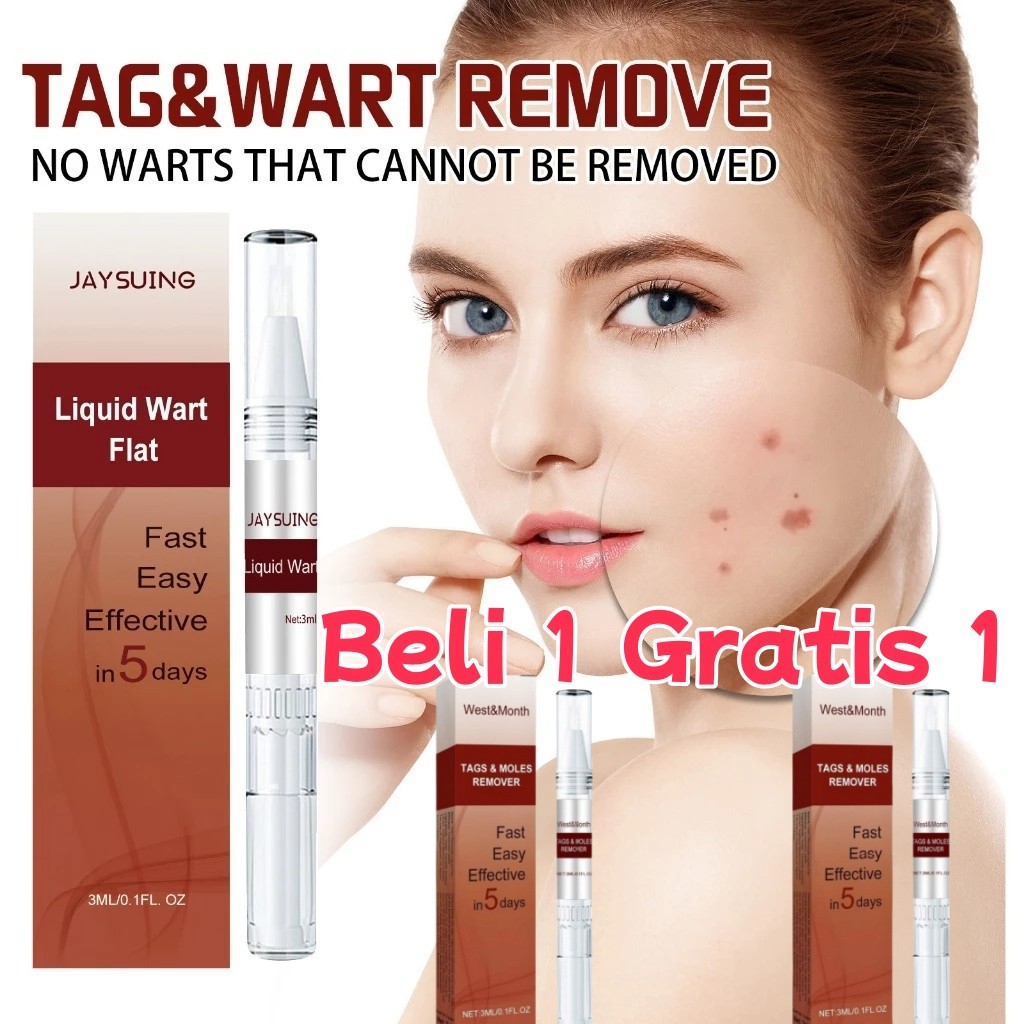 Jual penghilang tahi lalat di wajah kutil dan tahi lalat skin tag ...