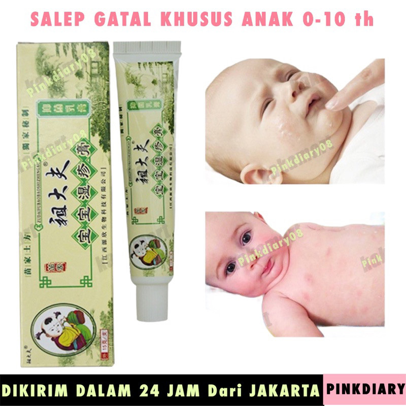 Jual ZUDAIFU Salep Obat Gatal bayi Anak-Anak balita obat eksim obat ...