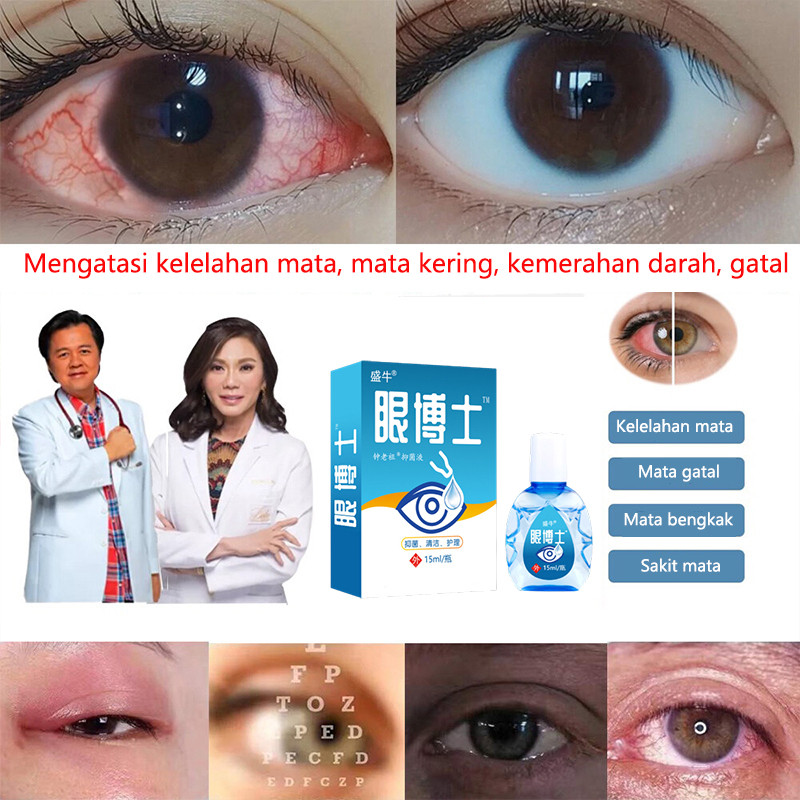 Jual Obat Mata 15ML Obat Tetes mata katarak Mata kering Sakit mata ...