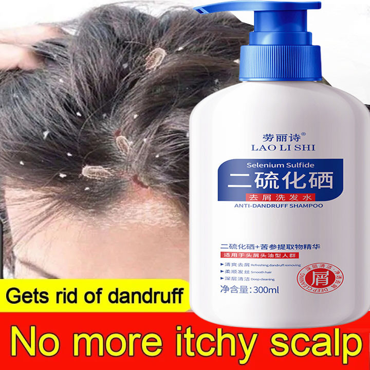 Jual Selenium Disulfide Shampoo Oil Control Anti-Dandruff Anti-Itch ...