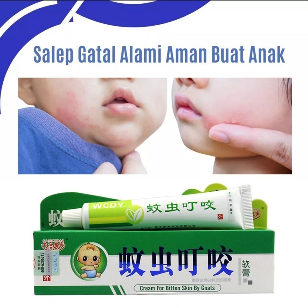 Jual Salep Gatal Paling Ampuh Untuk Anak Bayi Digigit Nyamuk Serangga ...