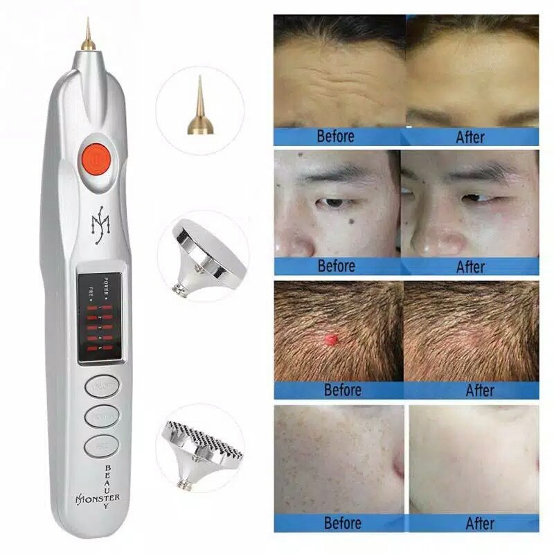 Jual Monster plasma Pen laser alat cauter penghilang flek kutil Kerut ...