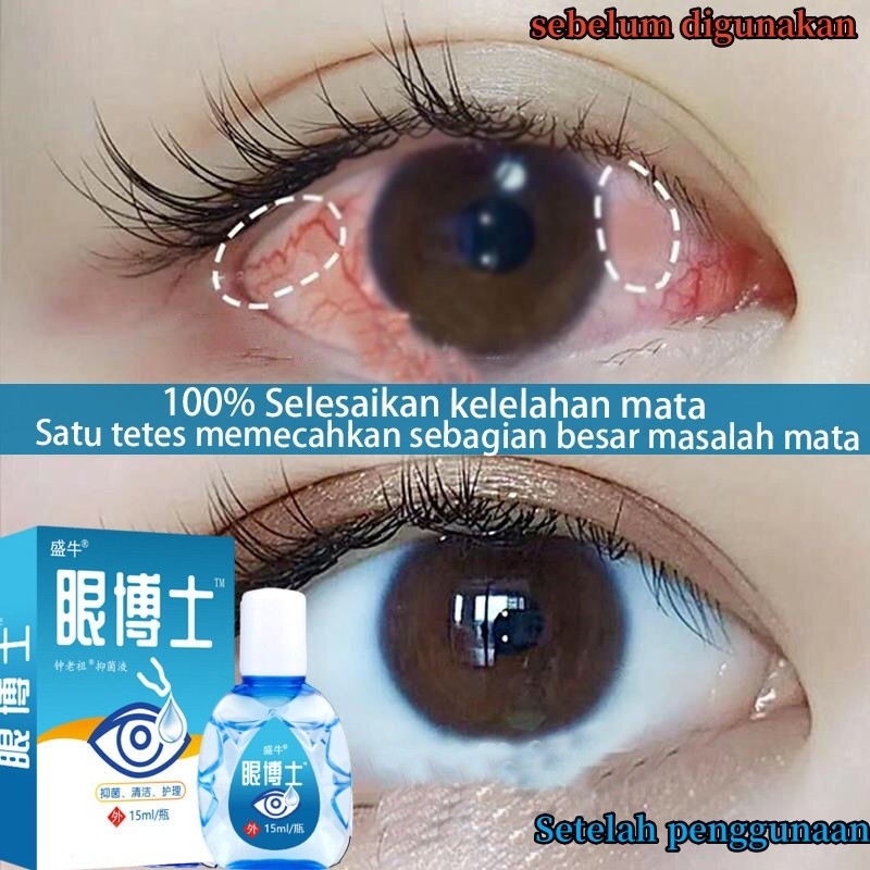 Jual Mata Katarak Obat Tetes Mata Eye Drops 15ml Mata Kering Sakit Mata ...