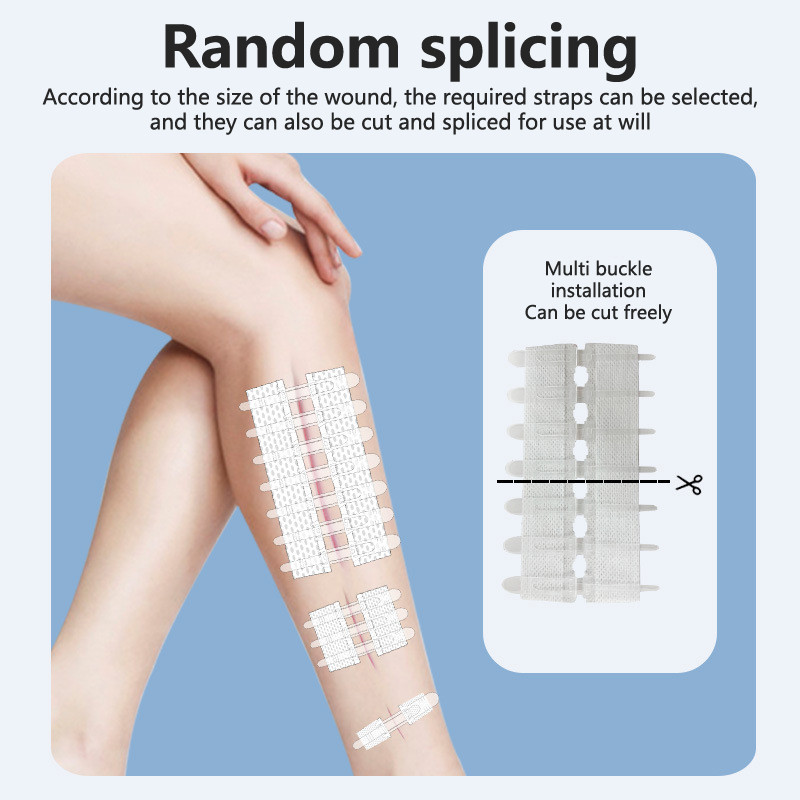 Jual Zip Stitch Wound Bandages Emergency Wound Closures Adhesive ...