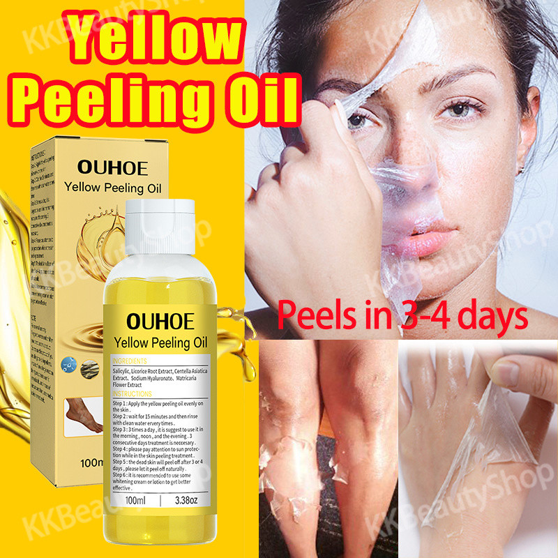 Jual OUHOE Yellow Peeling Oil Skin Oil Dark spot remover Whitening skin ...