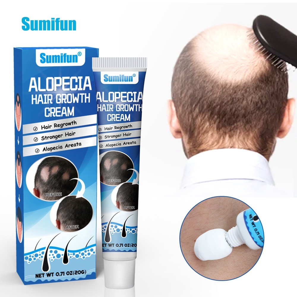 Jual Sumifun Obat Alopecia Areata, Rambut Pitak, Penumbuh Rambut Pitak ...