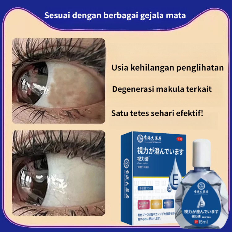 Jual *Kirim dalam 24 jam*Anti-fatigue Eye Drops/Instant Eye Correction ...