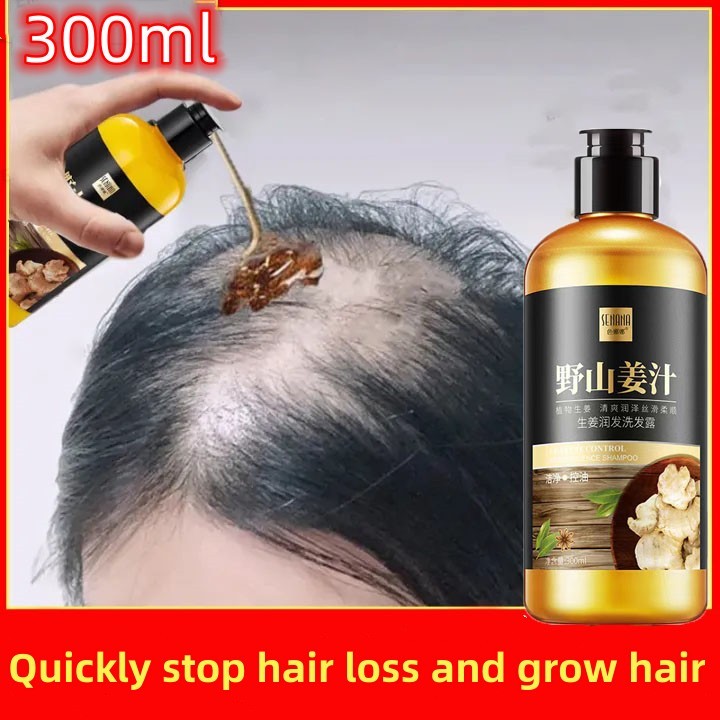 Jual Shampo Penumbuh Rambut Cepat Ginger Shampoo 300ml pertumbuhan rambut Pengendalian Minyak ...