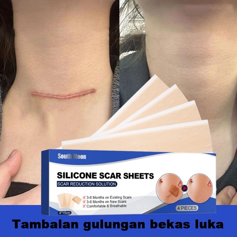 Jual Silicone Scar Sheet Gel 4PCS 4cm x 7.5cm plester silikon ...