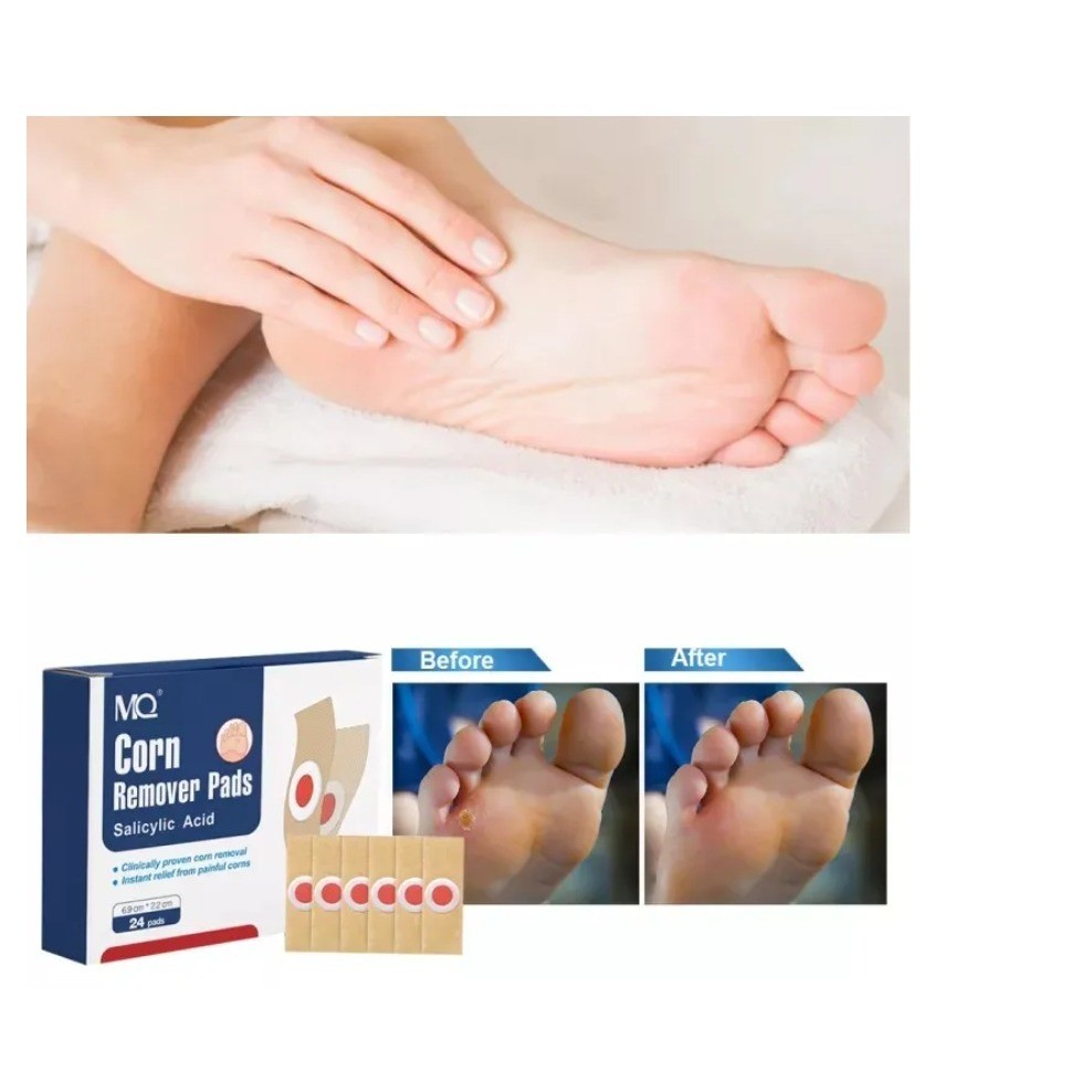 Jual PLASTER PLESTER KUTIL MATA IKAN KAPALAN DI TANGAN DAN KAKI FOOT ...