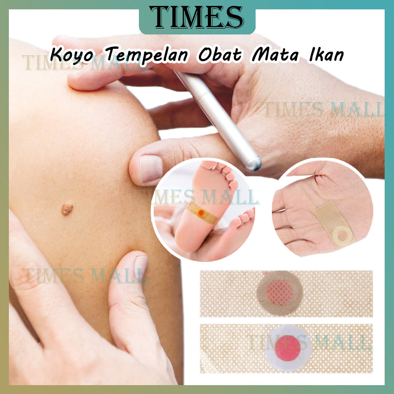 Jual Plester Mata Ikan/Penutup Kutil/Plester Kutil Ampuh/footcare Corn ...