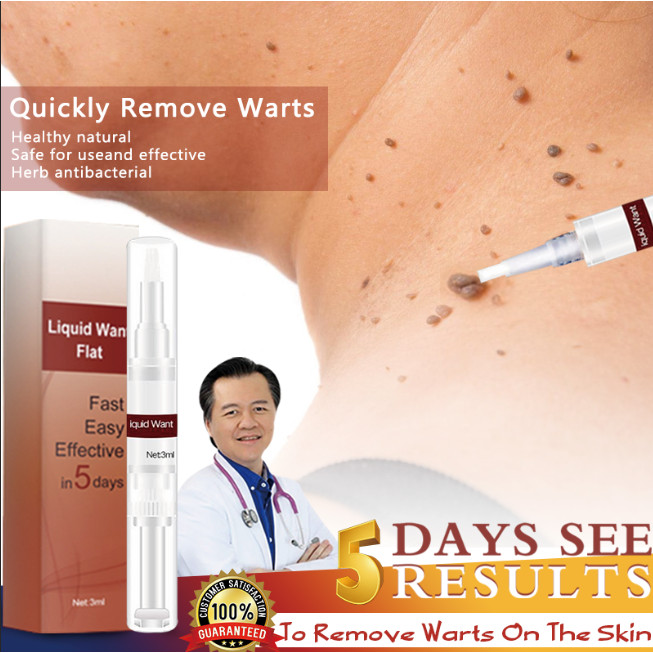 Jual Penghilang Kutil Dan Tahi Lalat Obat Penghilang Kutil Di Wajah ...