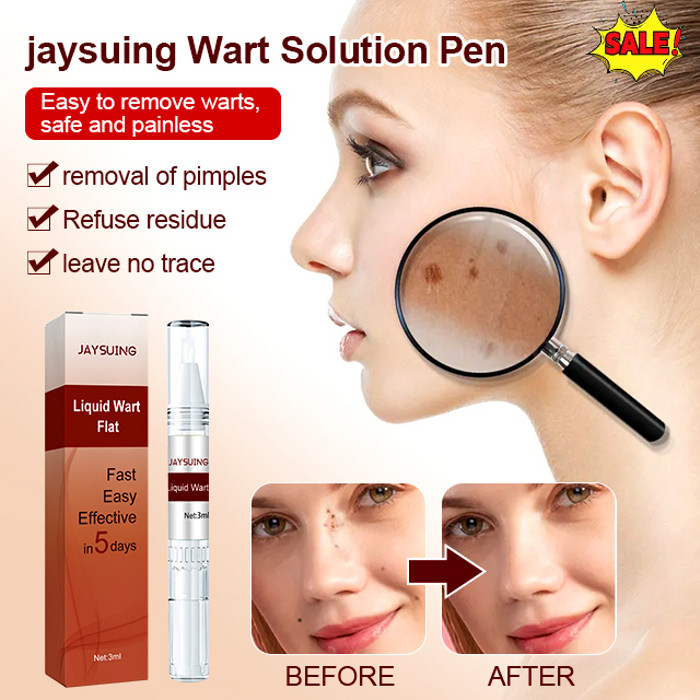 Jual Wart Removal Liquid Pen Flat Plantar Warts Mole Pointing Wart ...