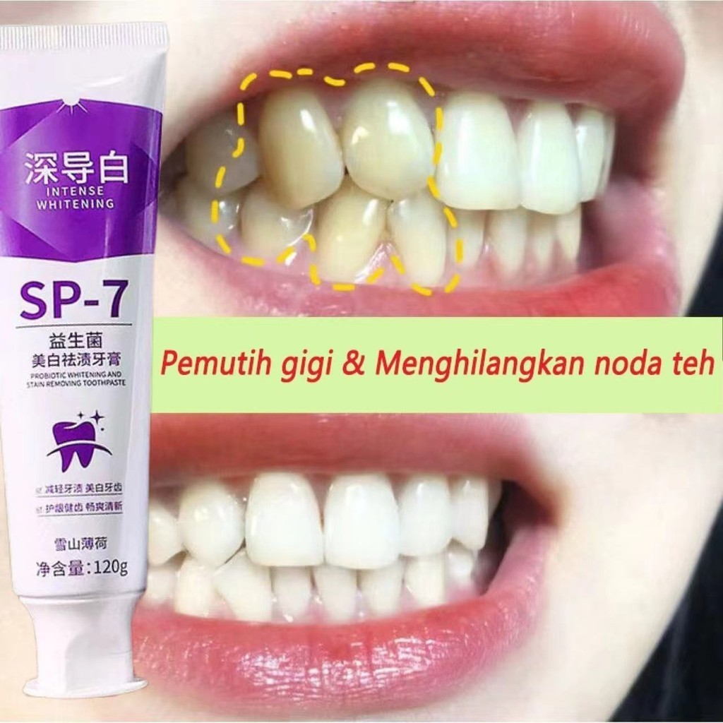Jual Pasta Gigi Probiotik SP-7 pemutih gigi dan karang gigi Mousse ...