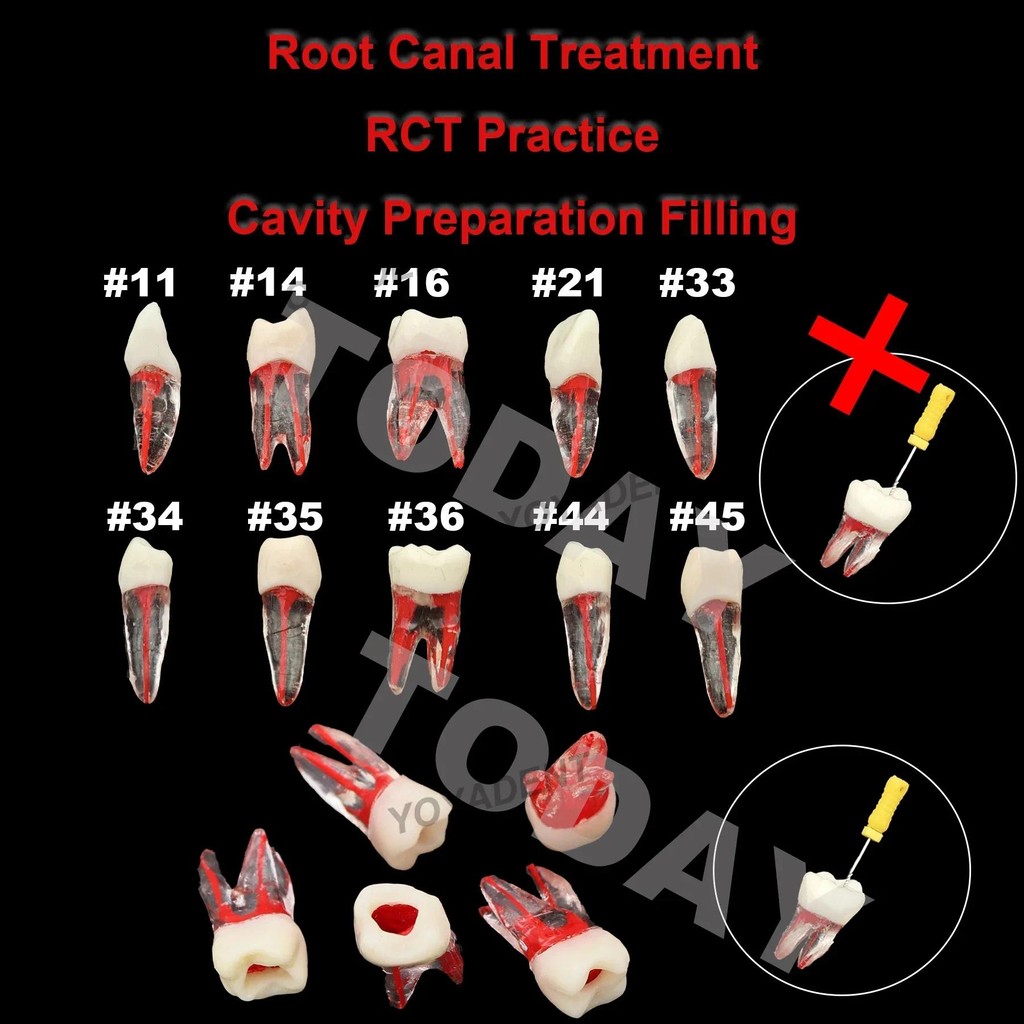 Jual Dental Endo Root Canal Treatment Study RCT Practice Model Kilgore ...