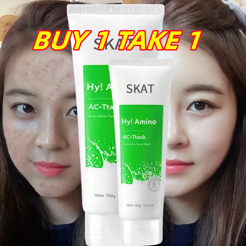 Jual YOU HY! SKAT Amino Facial Wash 100g | Anti Acne, Hydrating ...