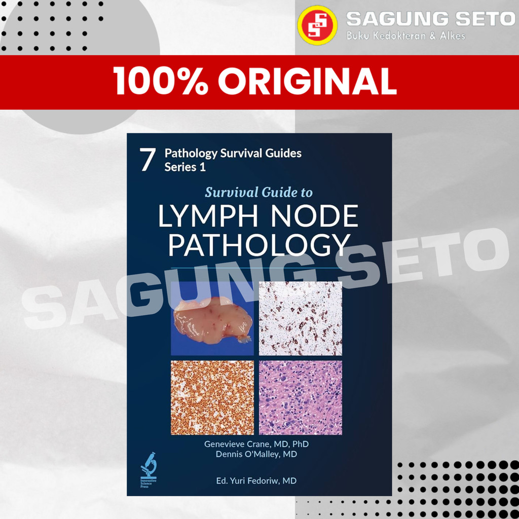 Jual BUKU SURVIVAL GUIDE TO LYMPH NODE PATHOLOGY -7 - CRANE | Shopee ...