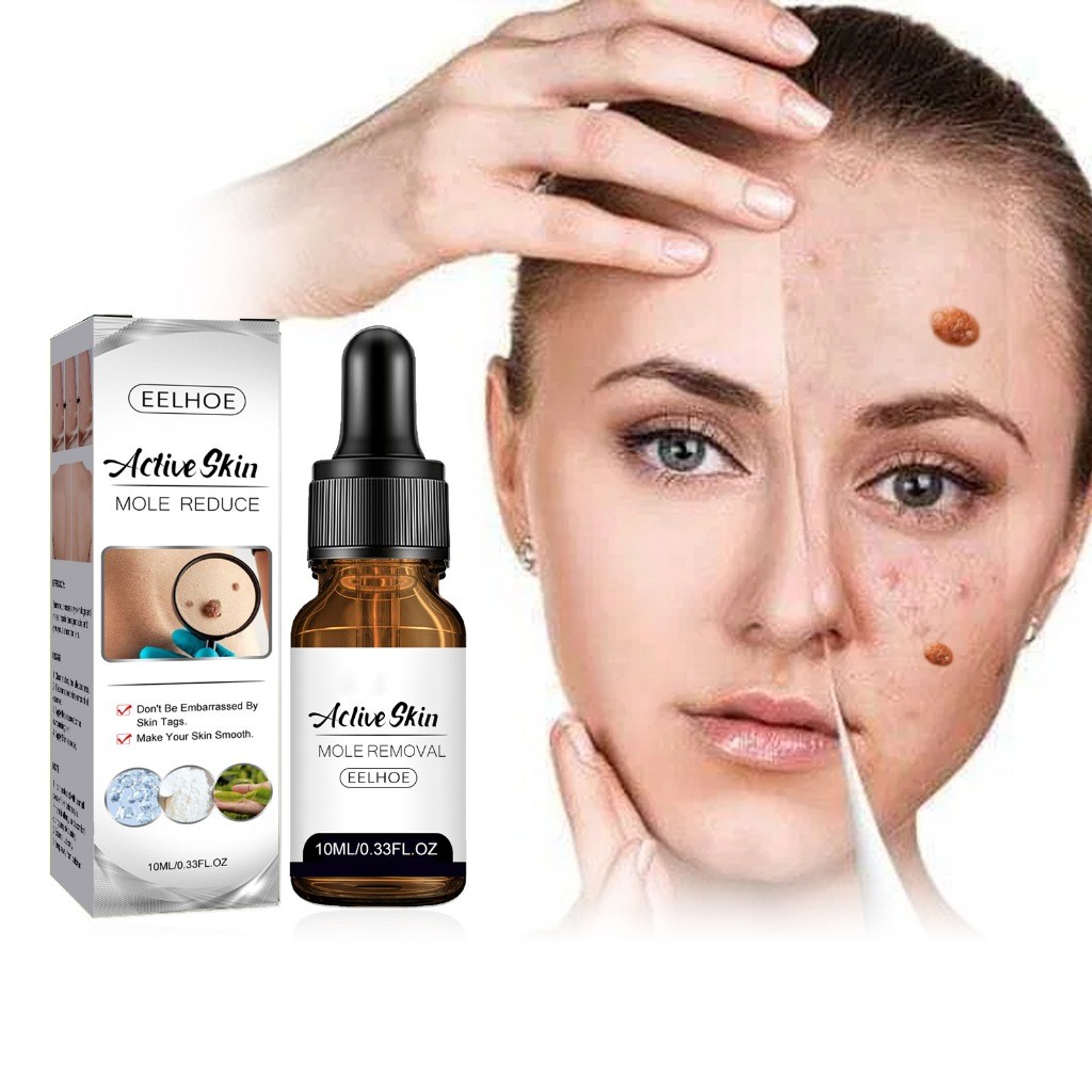 Jual EELHOE Skin Mole Removal 10ml Obat Kutil Penghilang Tahi Lalat Di ...