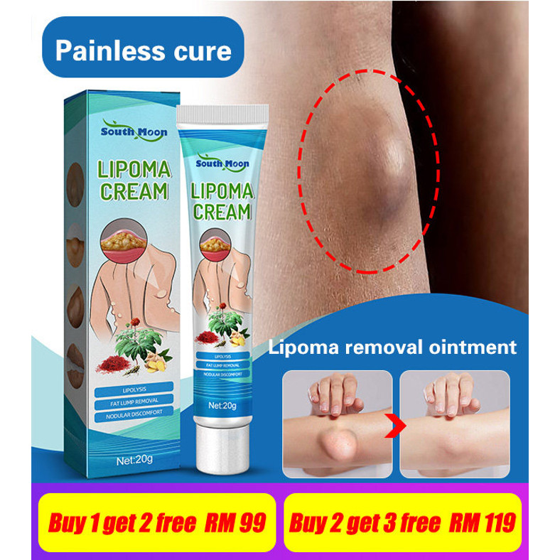 Jual Tumor Subcutaneous Lumps Fatty Knots Cream Body Care Relief ...
