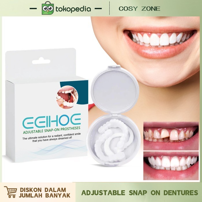 Jual KUAT BUAT MAKAN!!!!! Veneer Gigi Eelhoe Snap On Smile Gigi Palsu ...