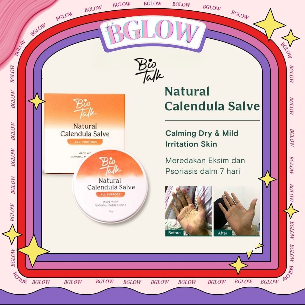 Jual Biotalk Natural Calendula Salve | No Steroid | Meredakan Kulit ...