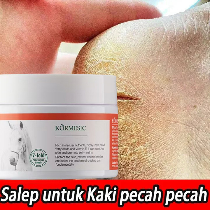 Jual Horse Oil Foot Hand Cream Tangan Kaki Krim Tumit Pecah-pecah ...