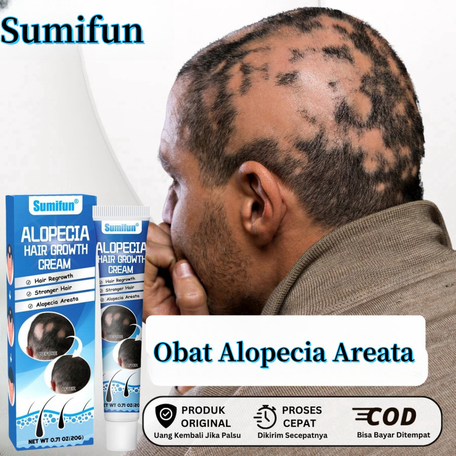 Jual Sumifun Obat Alopecia Areata, penumbuh rambut cepat Obat, penumbuh ...