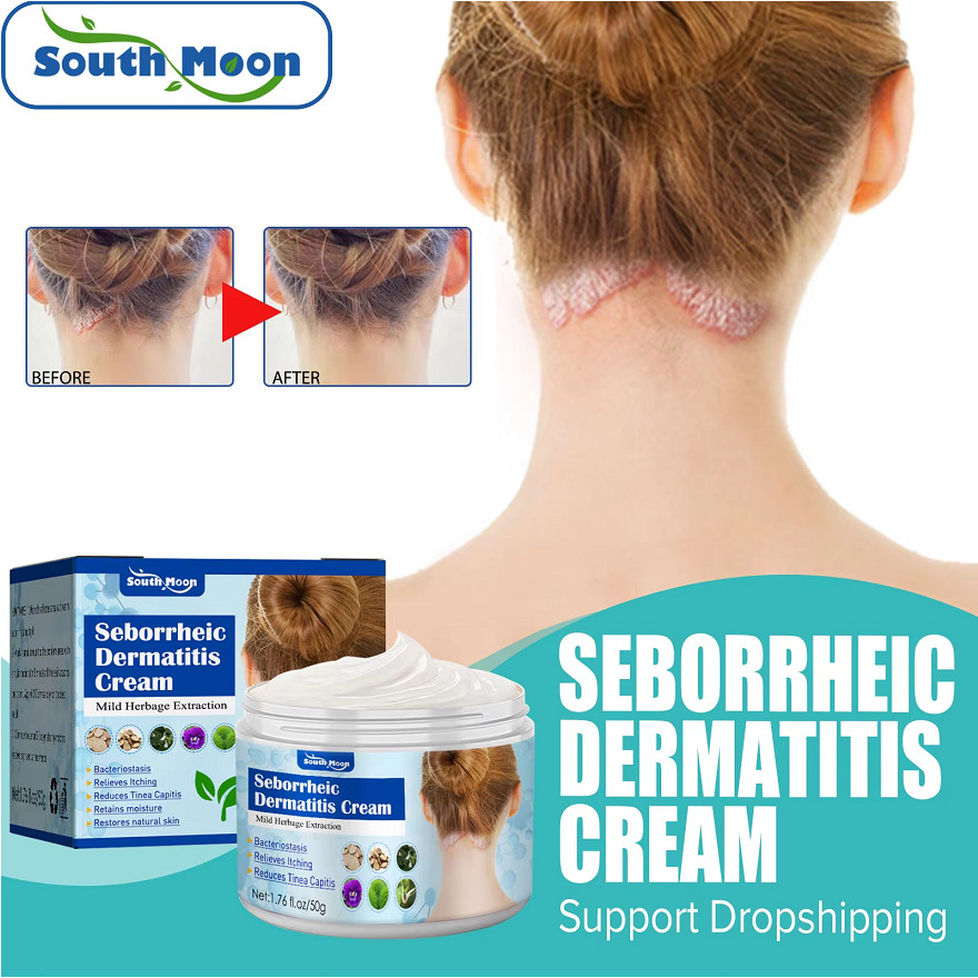 Jual Seborrheic Dermatitis Cream 50g Psoriasis Dermatitis Seboroik ...