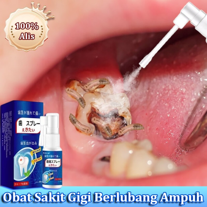 Jual 20ml Obat Gigi Berlubang, Penghancur gigi berlubang, gigi sering ...