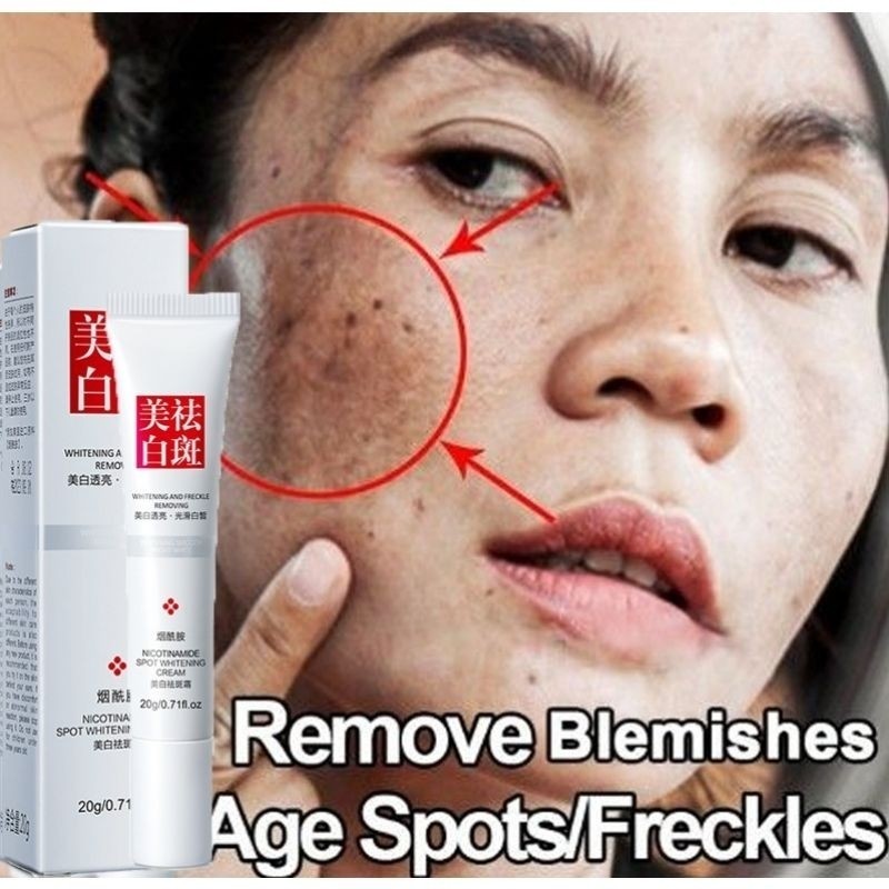 Jual Fuyan Nicotinamide Remove Freckle Dark Spot Cream Whitening Krim Penghilang Flek Hitam ...
