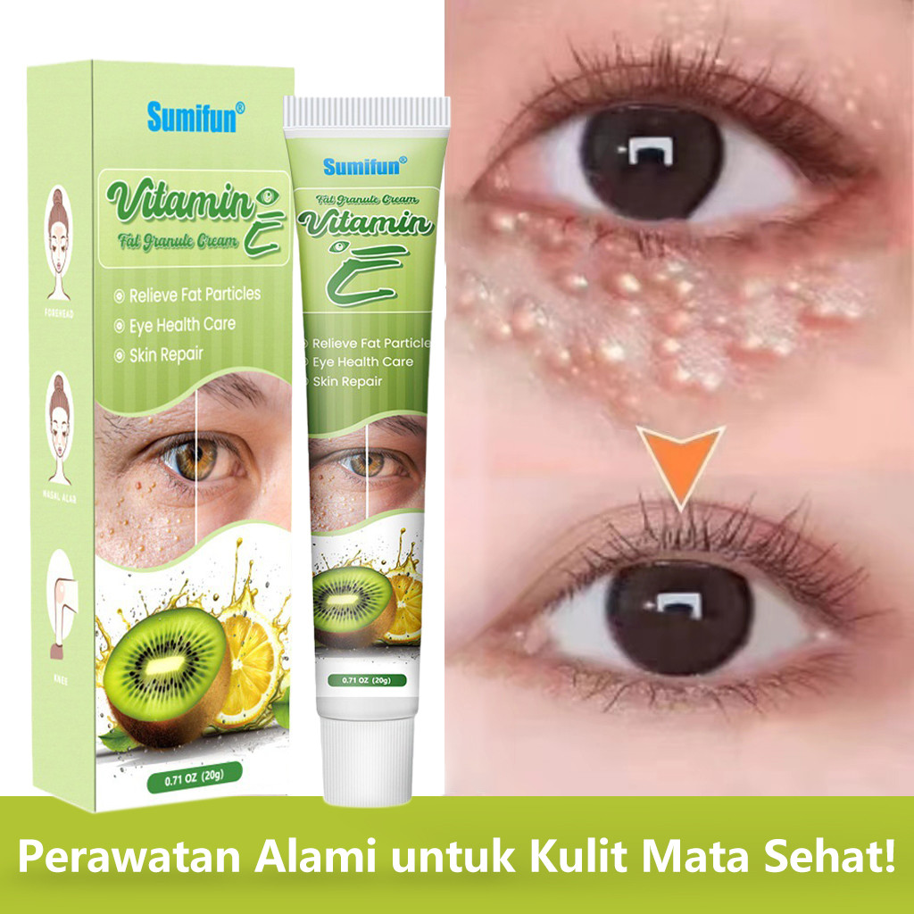 Jual Sumifun Vitamin E Krim Mata Mengurangi Butir Lemak & Kutil Mata ...
