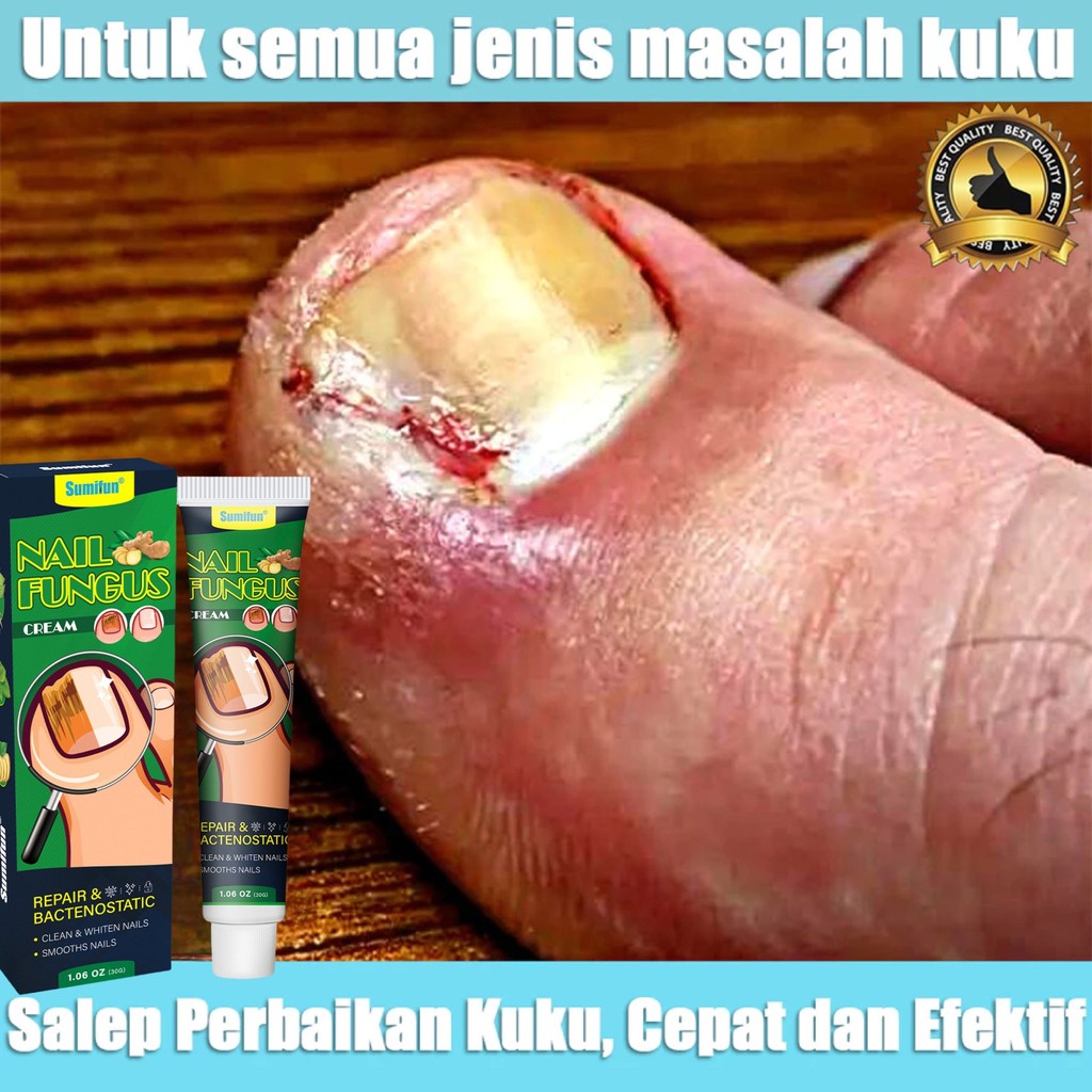 Jual Sumifun Nail Repair cream Original Serum Kuku | Perawatan Kuku ...