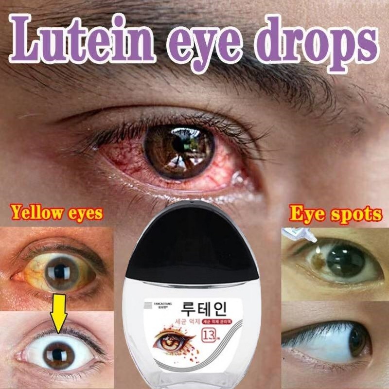 Jual Eye Drops Medication: Effective Solution for Cataracts, Dry Eyes ...