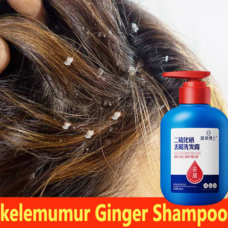 Jual New Style Selenium disulfide anti dandruff shampoo kelemumur ...