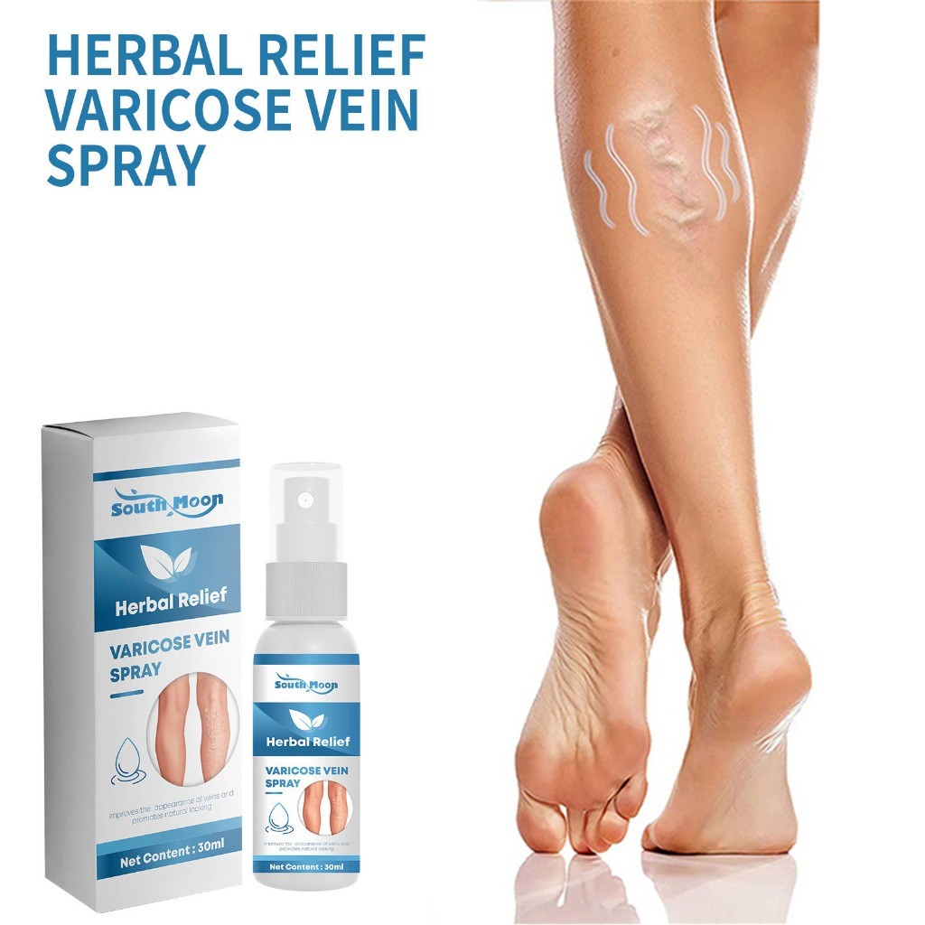 Jual South Moon Varicose Veins Spray 30ml Vasculitis Treatment Remove ...