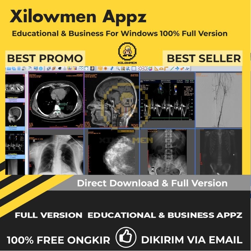 Jual [full Version] Sante Dicom Viewer 3d Pro Lifetime Viewer Untuk