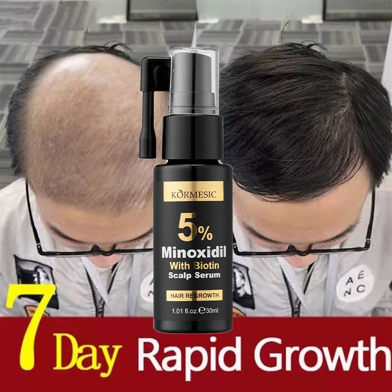 Jual Minoxidil Penumbuh Rambut Obat Penumbuh Rambut Botak, Tipis Dan ...