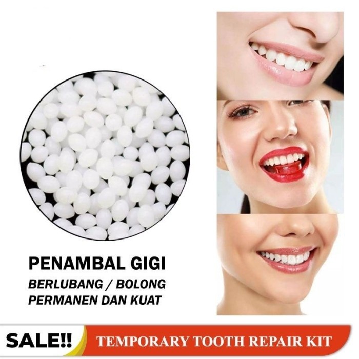 Jual Gigi Palsu 100 Butir Penambal Gigi Patah Renggang Temporary Tooth ...