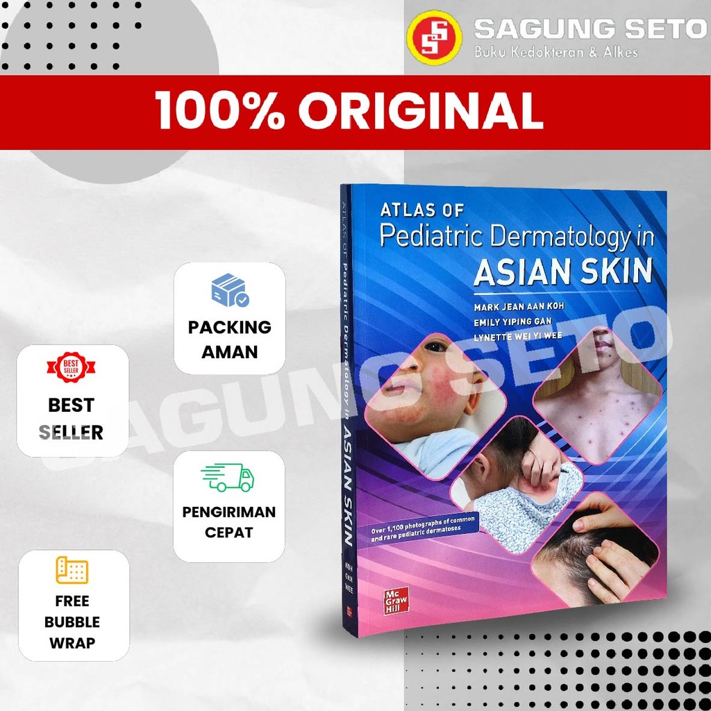 Jual BUKU ATLAS OF PEDIATRIC DERMATOLOGY ASIAN SKIN - KOH | Shopee ...