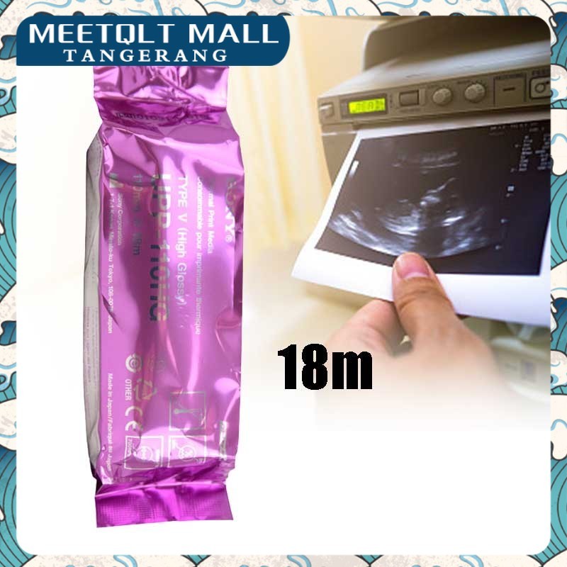 Jual Kertas USG Sony UPP 110HG Type V High Glossy UPP 110S Paper Sony Compatibel | Shopee Indonesia