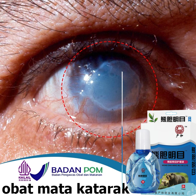 Jual Obat Mata Obat Tetes mata katarak Mata kering Sakit mata Darah ...