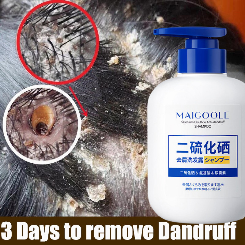 Jual Selenium Disulfide Shampoo 300ML Shampo anti ketombe Penghilang ...