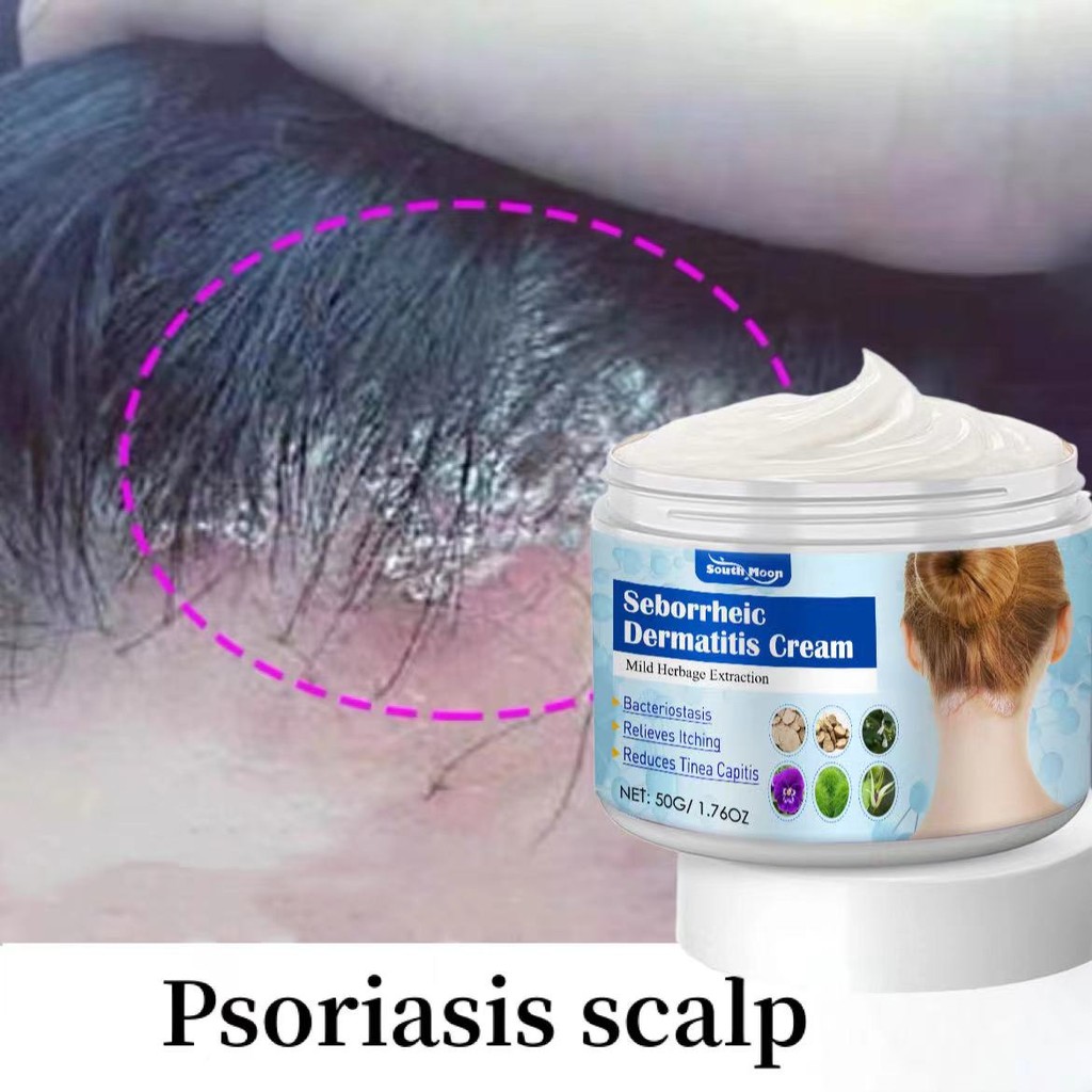 Jual Seborrheic Dermatitis Cream 50g, Krim Kulit Gatal Non-iritasi ...