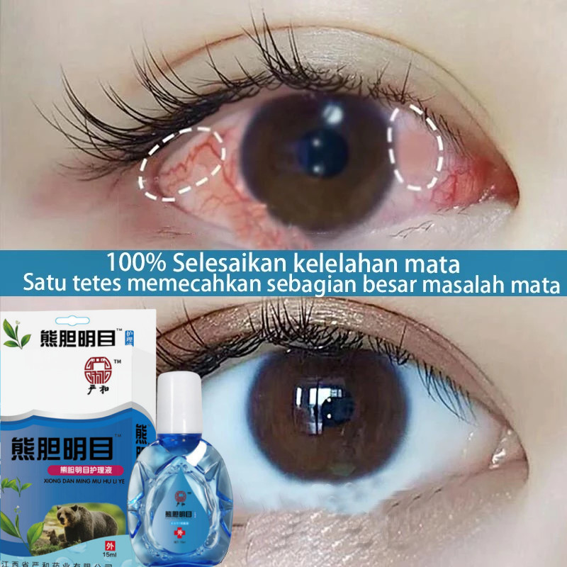 Jual Obat Tetes Mata Obat Mata Katarak Mata Kering Sakit Mata Darah ...