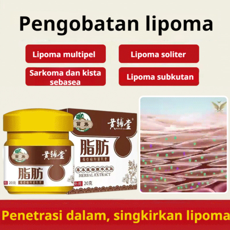 Jual 【COD+Kirim Dalam 24 Jam】lipoma cream original Salep Obat Cream ...