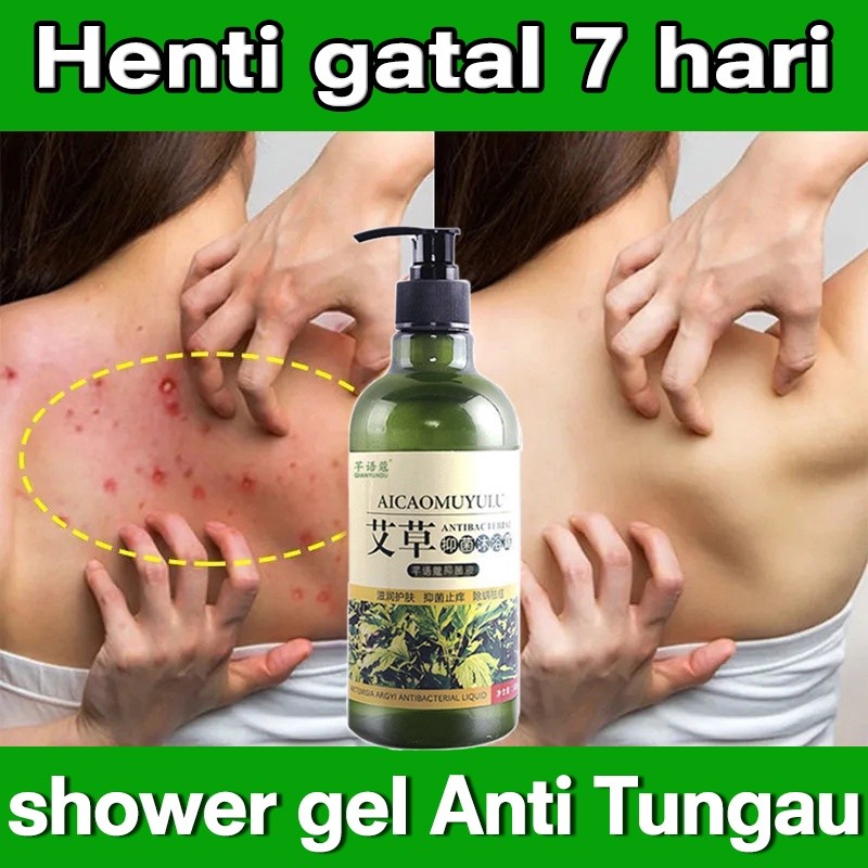 Jual Acne Body Wash Antibacterial Body Shampoo Anti Mite Shower Eczema Kulit Gatal Anti Fungus ...