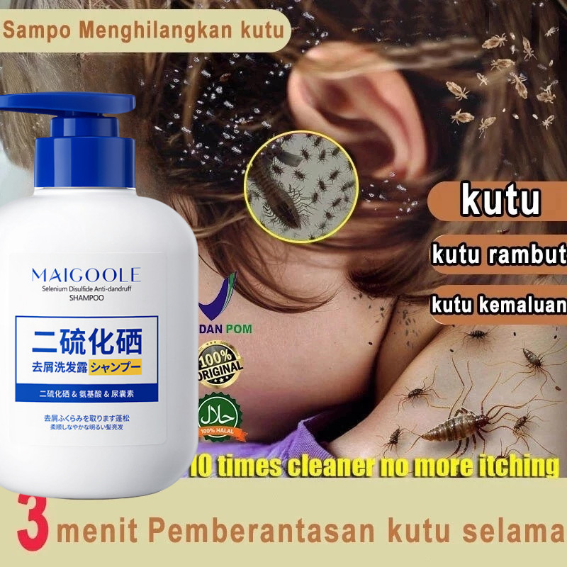 Jual Selenium Disulfide Shampoo Oil Control Anti-Dandruff Anti-Itch Clear Malassezia ...