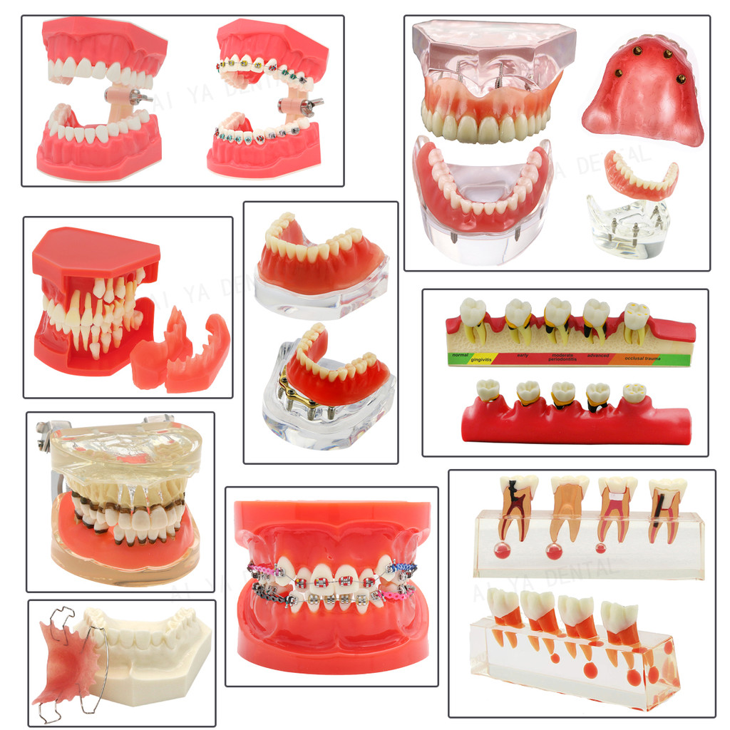 Jual Multiple Types Dental Teeth Model Dental Teaching Models Standard ...